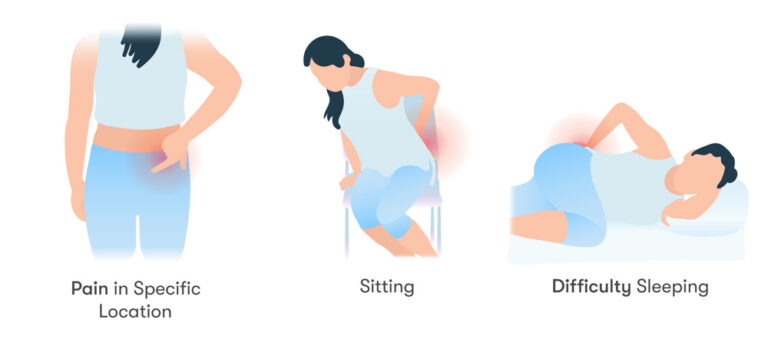 Sacroiliac Joint Injections | Joint Injections For Arthritis | Pain ...